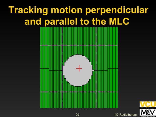 4D Radiotherapy | PPT
