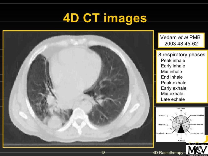 4D Radiotherapy