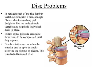 Lifting and Your Back | PPT