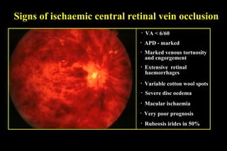 Retinal Vascular occlusion | PPT