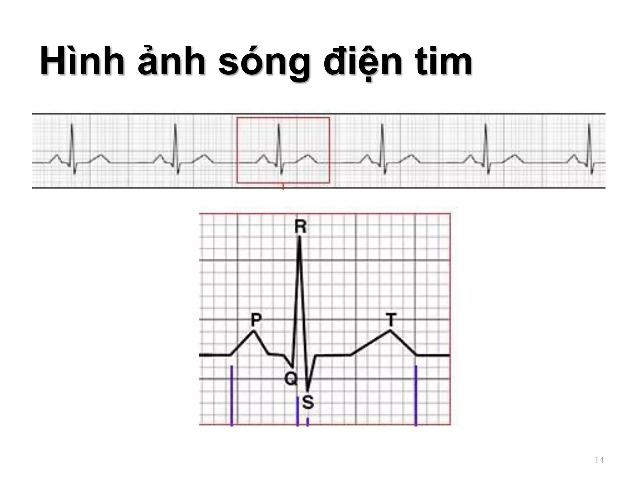 CÁC BƯỚC ĐỌC ECG | PDF