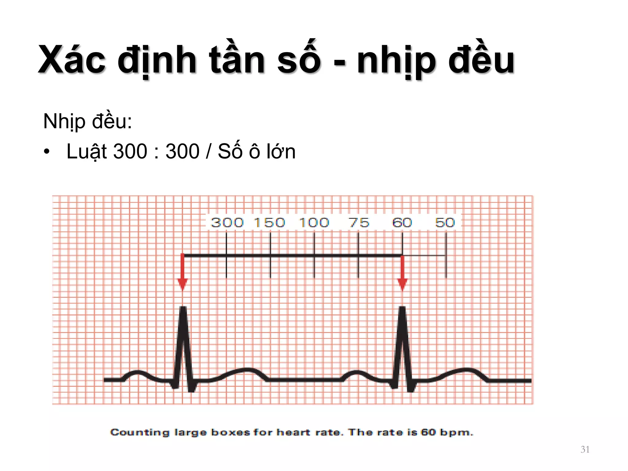 CÁC BƯỚC ĐỌC ECG | PDF