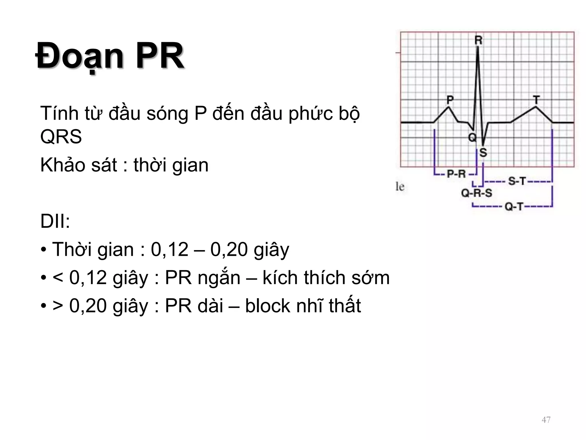 CÁC BƯỚC ĐỌC ECG | PDF