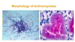 General microbiology fungi Actinomycetes | PPT