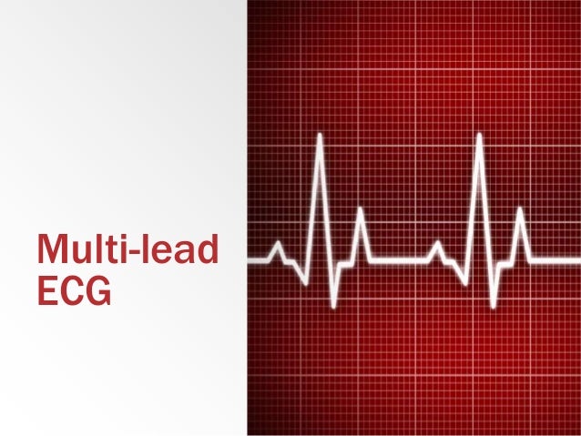 Tcad Multi Lead Ecg