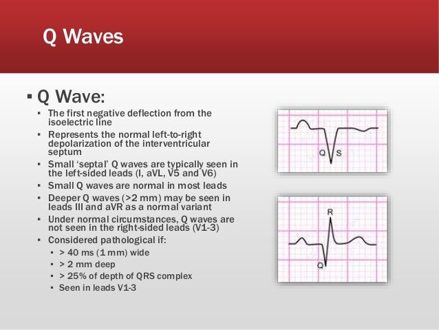 TCAD - Multi-lead ECG