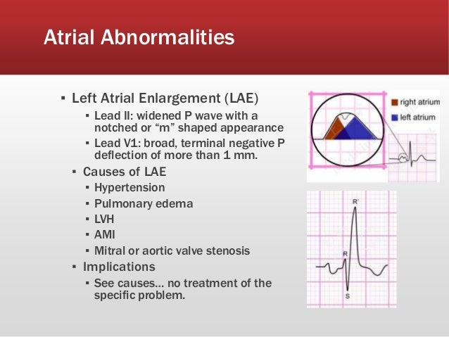 TCAD - Multi-lead ECG