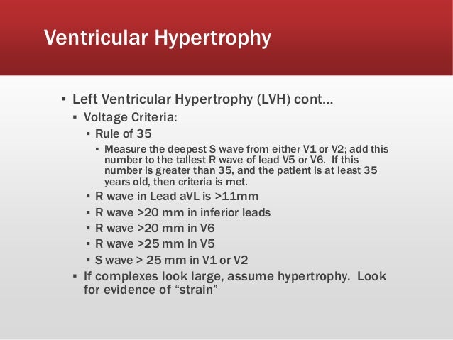 TCAD - Multi-lead ECG