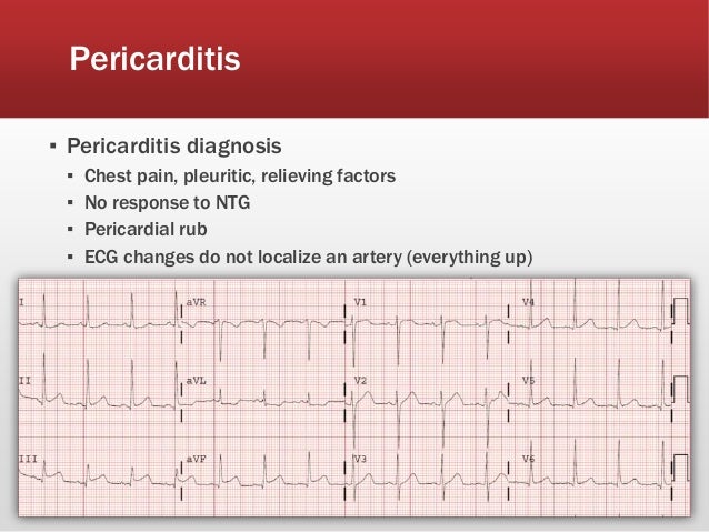 TCAD - Multi-lead ECG