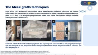 YUD Burn 2 Meek micrografting history, indications, technique ...
