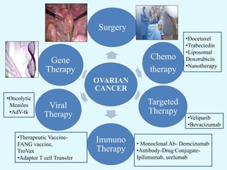 Prophylactic Salpingectomy | PPTX