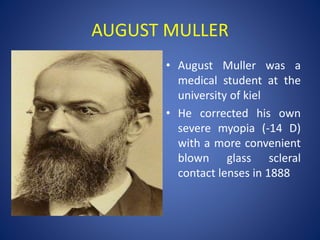 History of contact lenses | PPTX