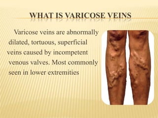 Ywca varicose veins | PPT