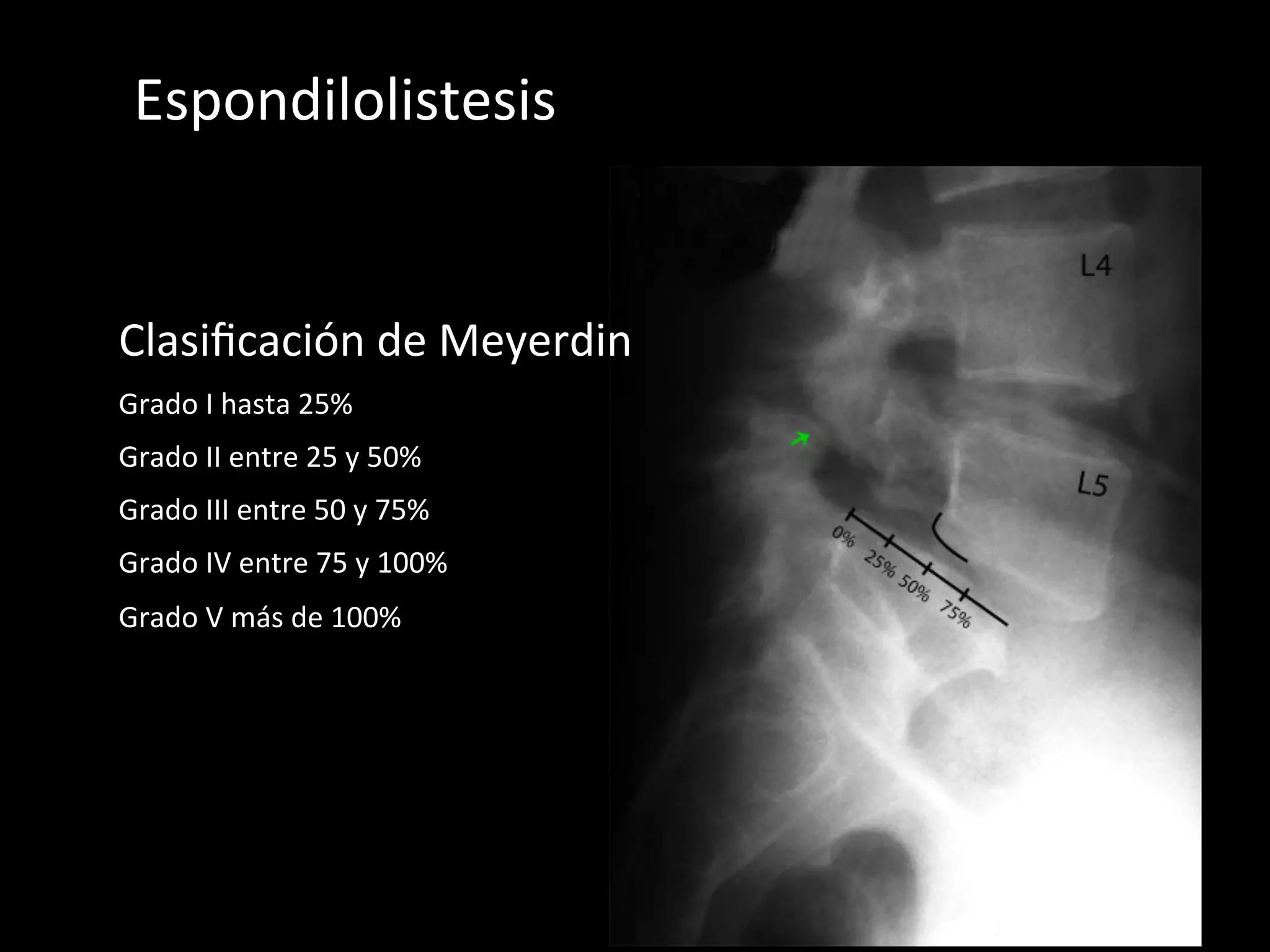 Rx de la región lumbar y la pelvis | PDF