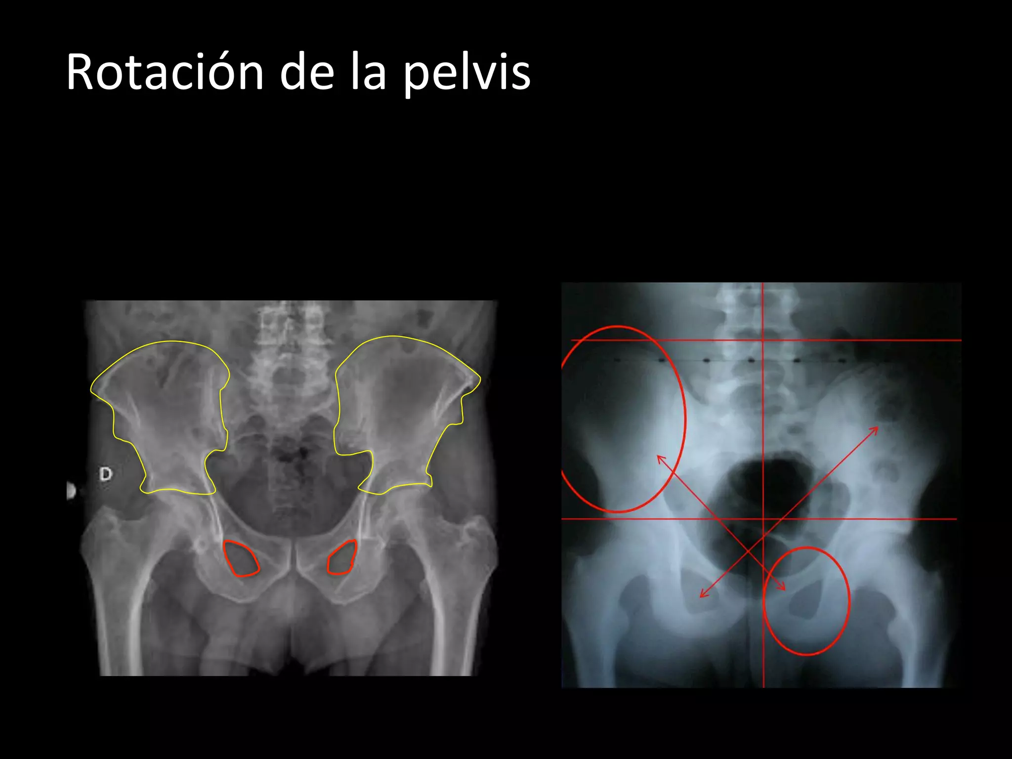 Rx de la región lumbar y la pelvis | PDF