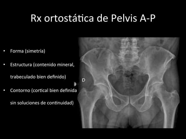Rx de la región lumbar y la pelvis | PDF