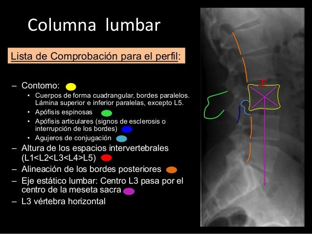Rx de la región lumbar y la pelvis