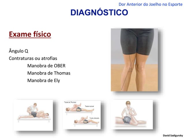 Síndrome Femoropatelar