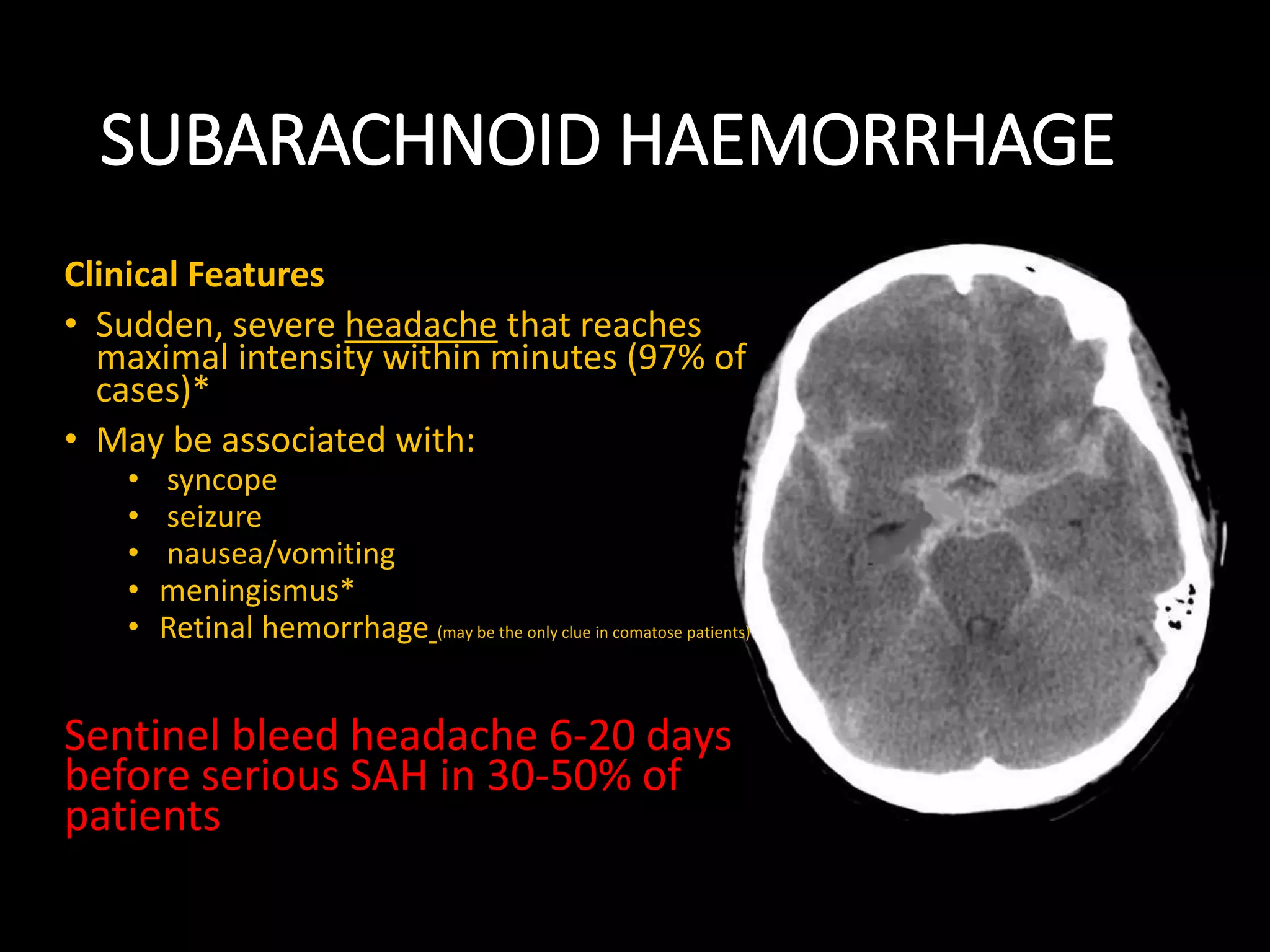 Induction teaching head injury & headache | PDF