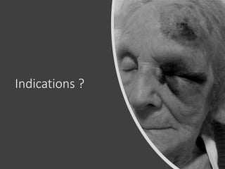 Induction teaching head injury & headache | PPT