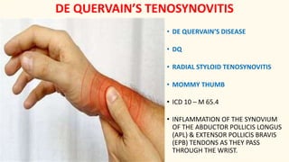 DE QUERVAIN'S TENOSYNOVITIS | PPTX