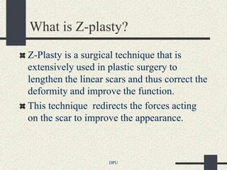 Z plasty | PPTX