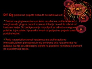 Zaboluvanja na endodontot | PPT