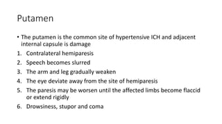 intra cranial hemorrhage | PPTX