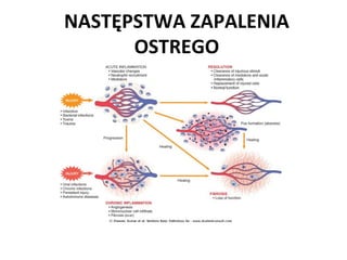Zapalenia patogeneza | PPT