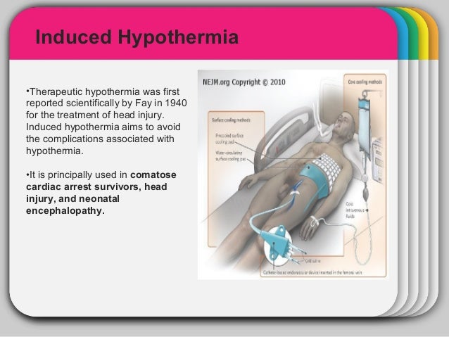 Thermoregulation: Implications of Hypothermia & Hyperthermia in Anaes…