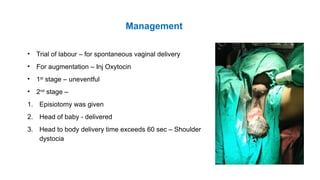 Zavanelli procedure, its use and complication | PPTX