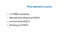 Zavanelli procedure, its use and complication | PPTX
