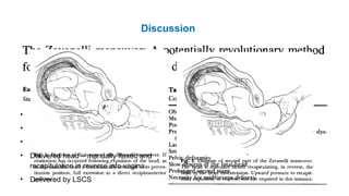 Zavanelli procedure, its use and complication | PPTX