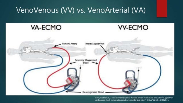 Z ben ma ecmo pgy 3 talk