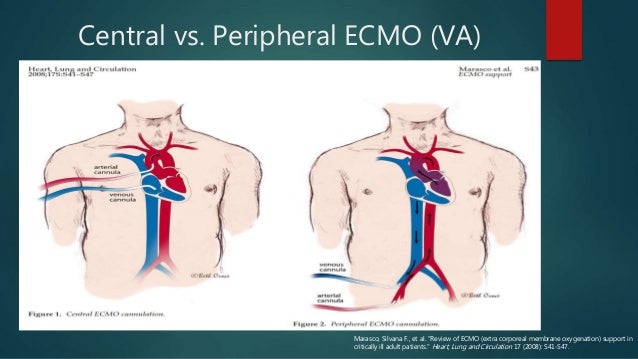 Z ben ma ecmo pgy 3 talk