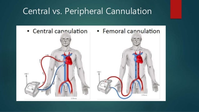 Z ben ma ecmo pgy 3 talk