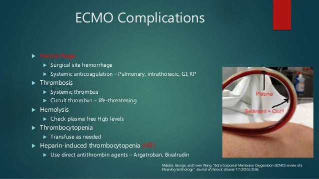 Z ben ma ecmo pgy 3 talk