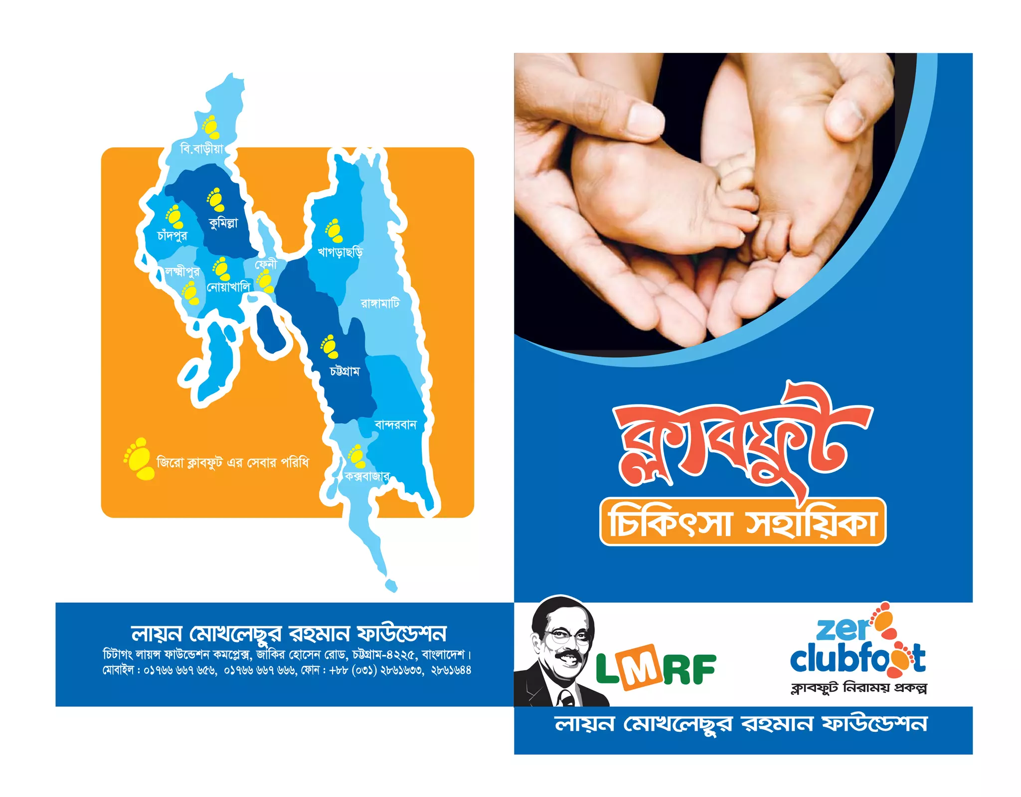 Clubfoot Treatment Guideline | PDF