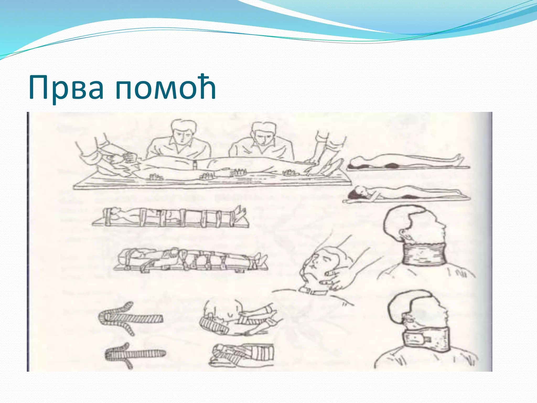 Imobilizacija kičmenog stuba | PPTX