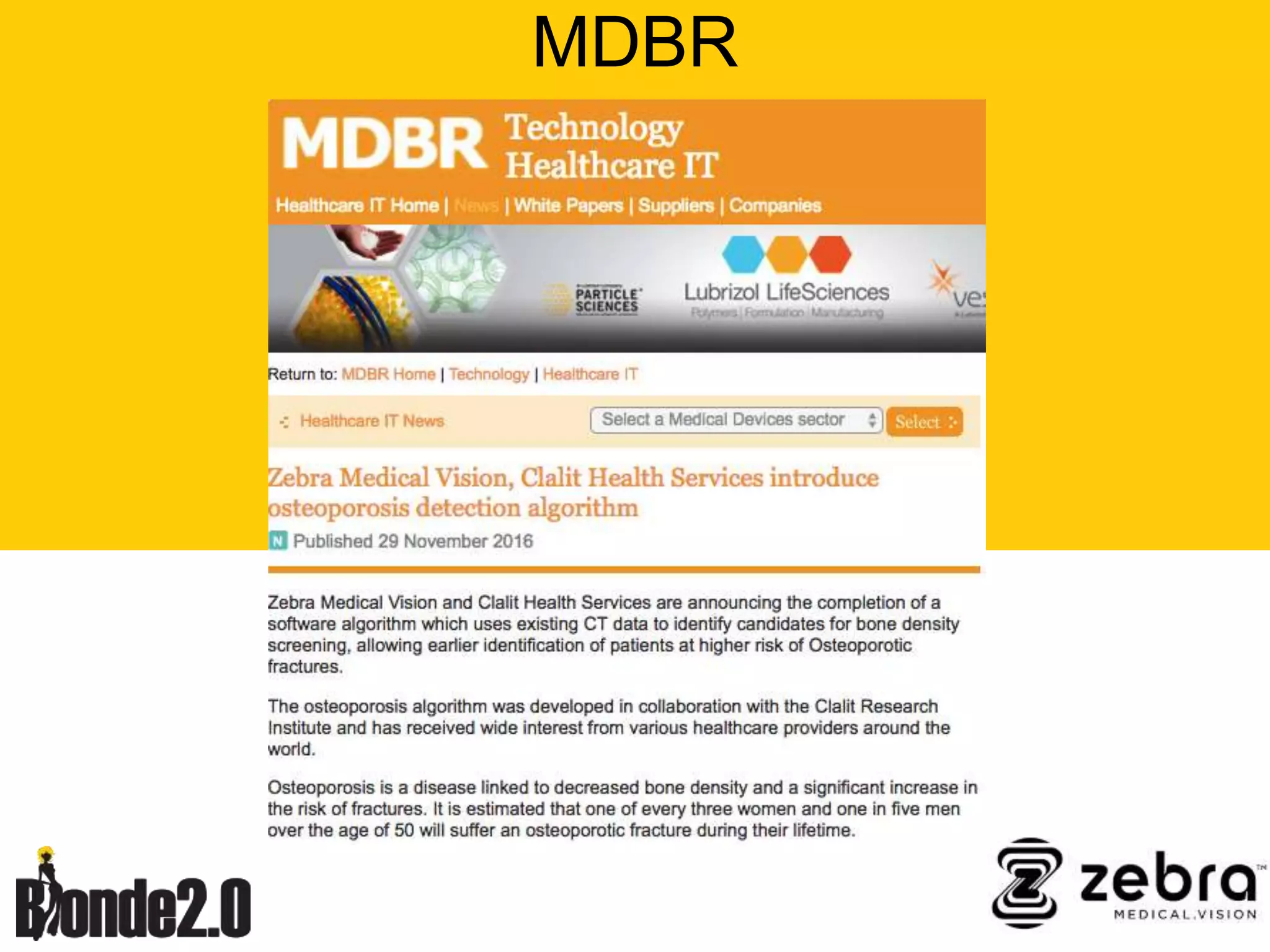 Zebra case study | PPTX