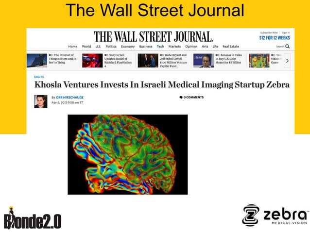 Zebra case study | PPTX