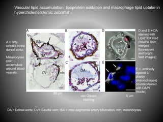 Zebrafish Model & Atherosclerosis | PPSX