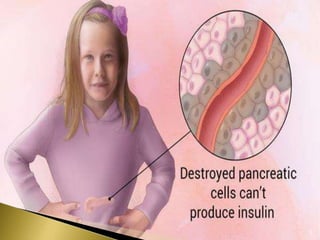 diabetes case study | PPTX