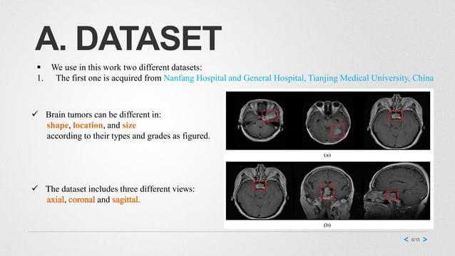 MULTI-CLASSIFICATION OF BRAIN TUMOR IMAGES USING DEEP NEURAL NETWORK | PPT