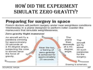 Zero gravity surgery | PPT
