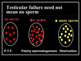 Zero sperm count what the gynecologist should know by dr rupin shah, md ...