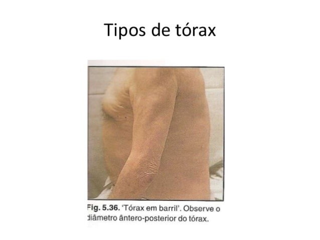 Exame físico do tórax