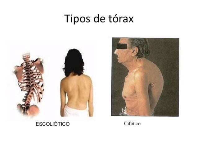 Exame físico do tórax