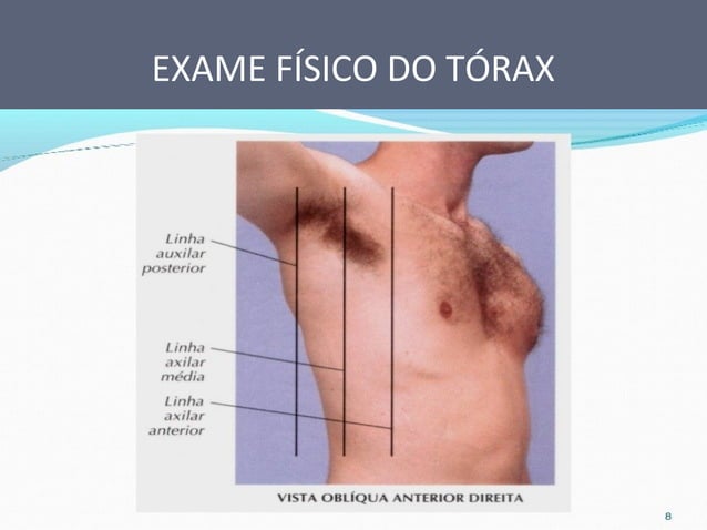 Exame físico do tórax