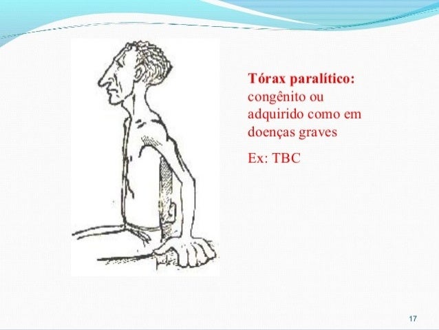 Exame físico do tórax